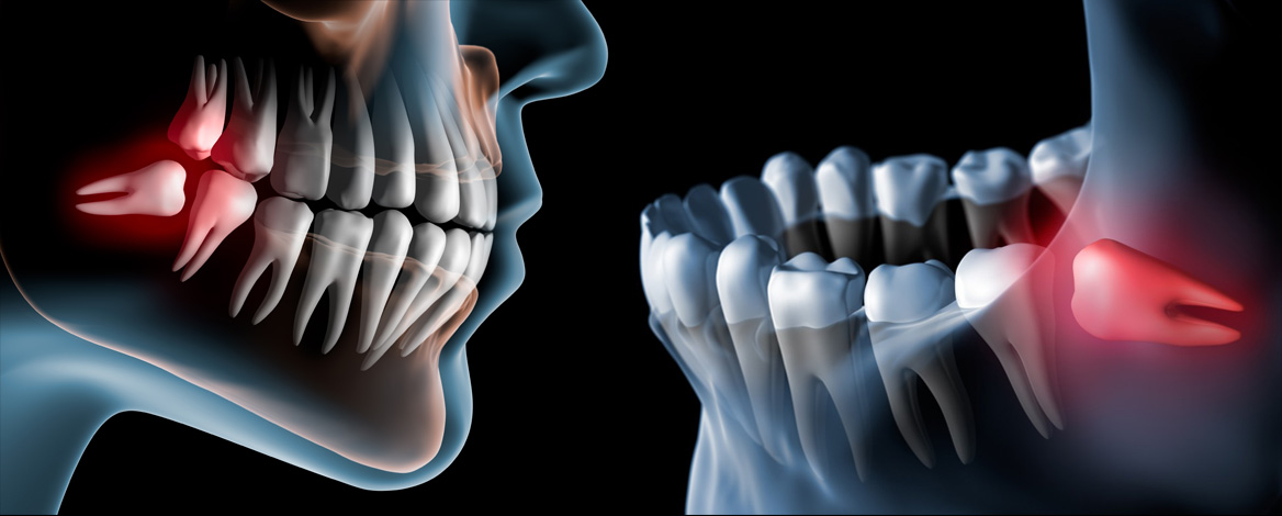CHIRURGIA ODONTOSTOMATOLOGICA (o CHIRURGIA ORALE)